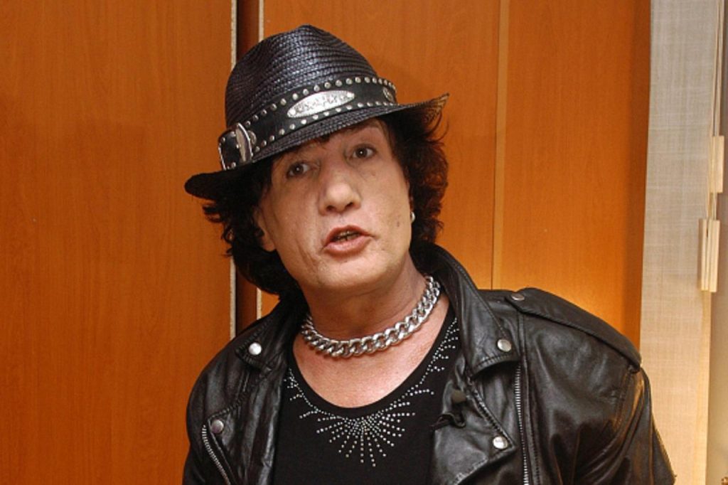 Milić Vukašinović nakon amputacije noge pozirao i pozdravio fanove ...