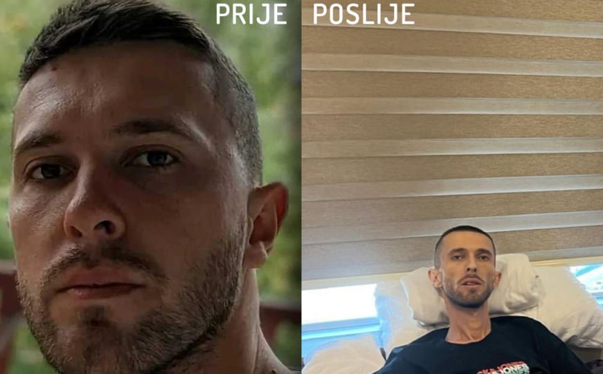 Vrijeme je presudno: Spasimo život Hikmetu Adiloviću (33), Pomozi.ba ...